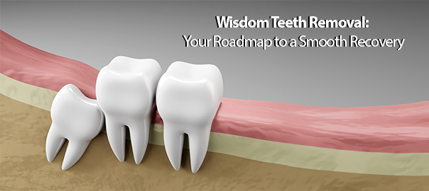 How Smoking Affects Wisdom Tooth Removal Recovery?